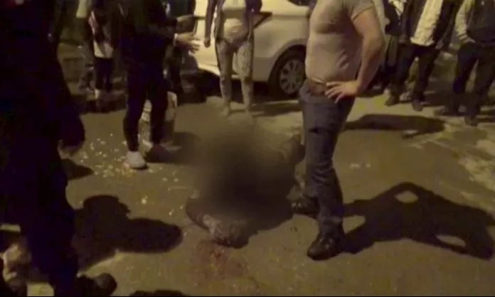 Cajamarca: video muestra cómo la mujer quemada recibió primeros auxilios