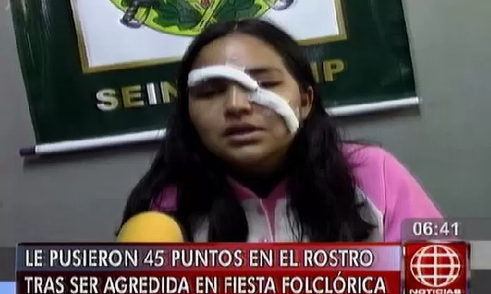 Joven Quedó Desfigurada Por Negarse A Bailar Con Otra Mujer En Una Fiesta