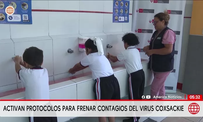 Brote virus Coxsackie en Perú: Reportan más de 300 casos