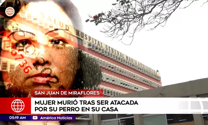 SJM: Mujer murió tras ser atacada por su perro pitbull