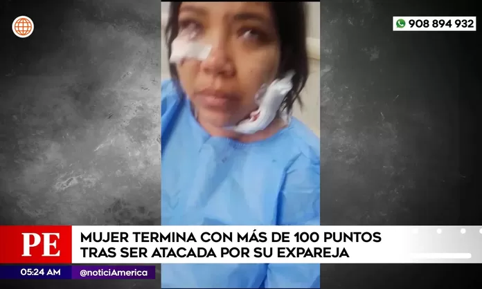 SMP: Hombre atacó y desfiguró a su expareja