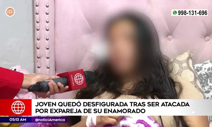 Sjm Mujer Desfigurada Tras Ataque De Expareja De Enamorado