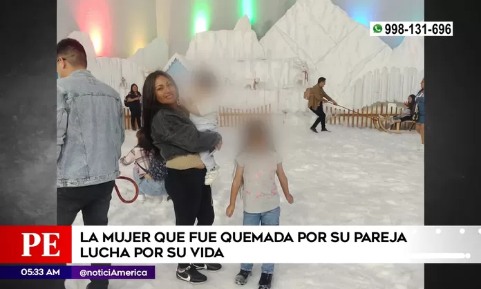 VES: Mujer quemada por su pareja lucha por su vida