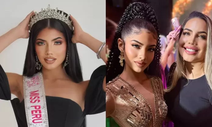 Hija de Anhelí y Dayron sufre accidente con fuegos artificiales