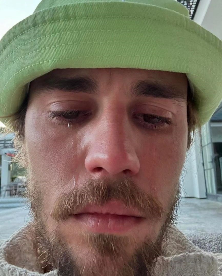Justin Bieber preocupó a sus seguidores con estas fotos - América Noticias
