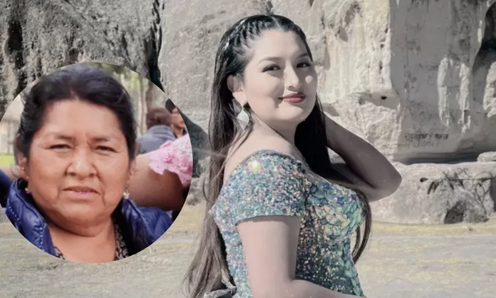 ‘Muñequita Milly’ pidió perdón por haberse operado