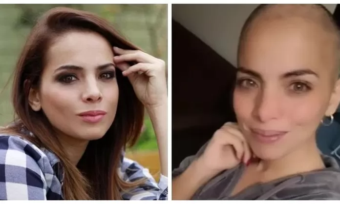 Sofía Bogani, actriz de 'Así es la Vida', lucha contra el cáncer de mama
