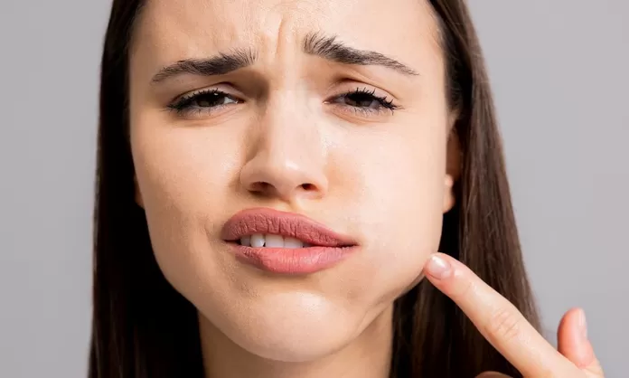 Cara hinchada por muela del juicio