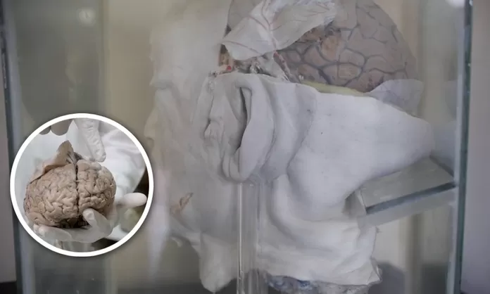 ¿Cómo es el cerebro de una persona que muere? 5 datos sobre este órgano
