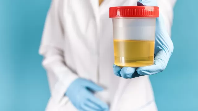 Cuál es el color normal de la orina y significado - América Noticias
