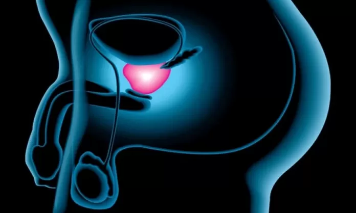 Cómo se hace el examen de tacto rectal