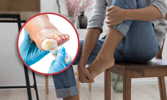 ¿Por qué sales los uñeros y cómo se curan?