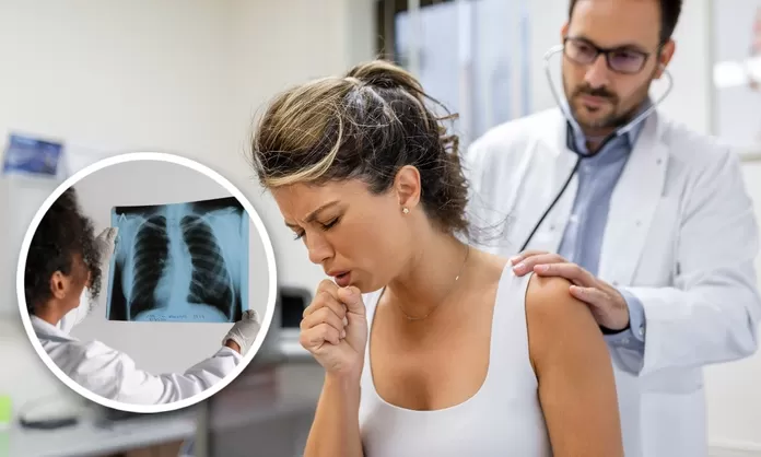 ¿Por qué tengo tos y cuál es el tratamiento?