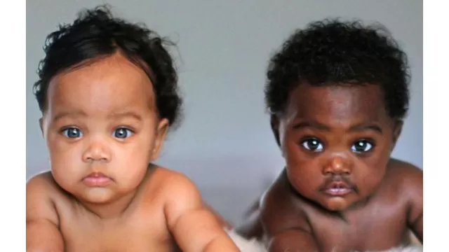 Gemelas con diferente color de piel: ¿Por qué nacen así? - América Noticias